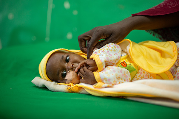 Save the Children | Ondervoeding: schokkende feiten